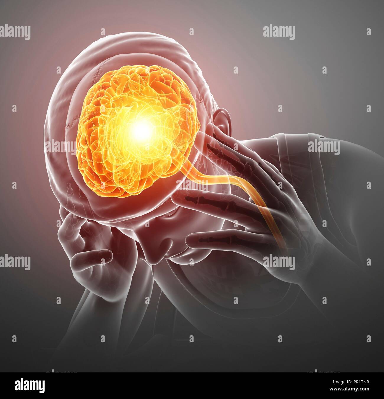 Man with headache, computer illustration Stock Photo - Alamy
