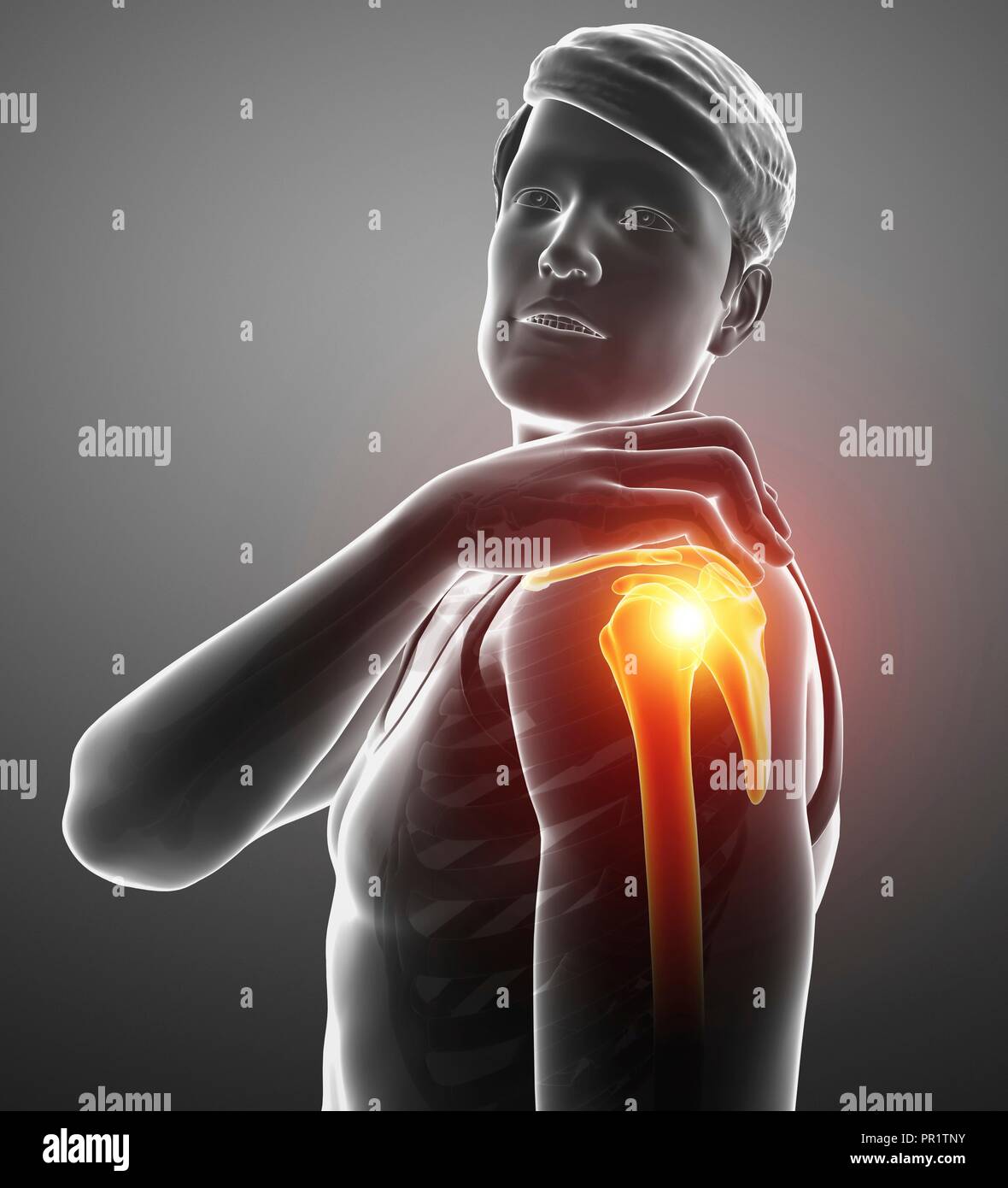 Man with shoulder pain, computer illustration Stock Photo - Alamy