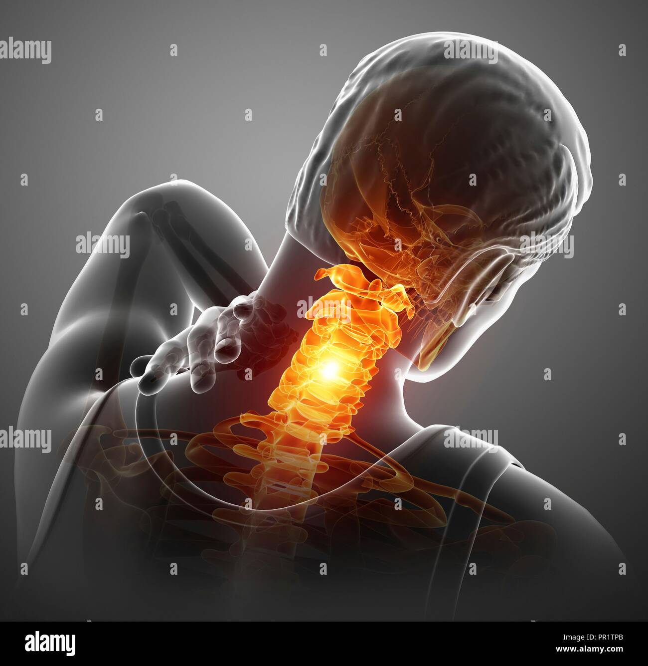Man with neck pain, computer illustration Stock Photo - Alamy