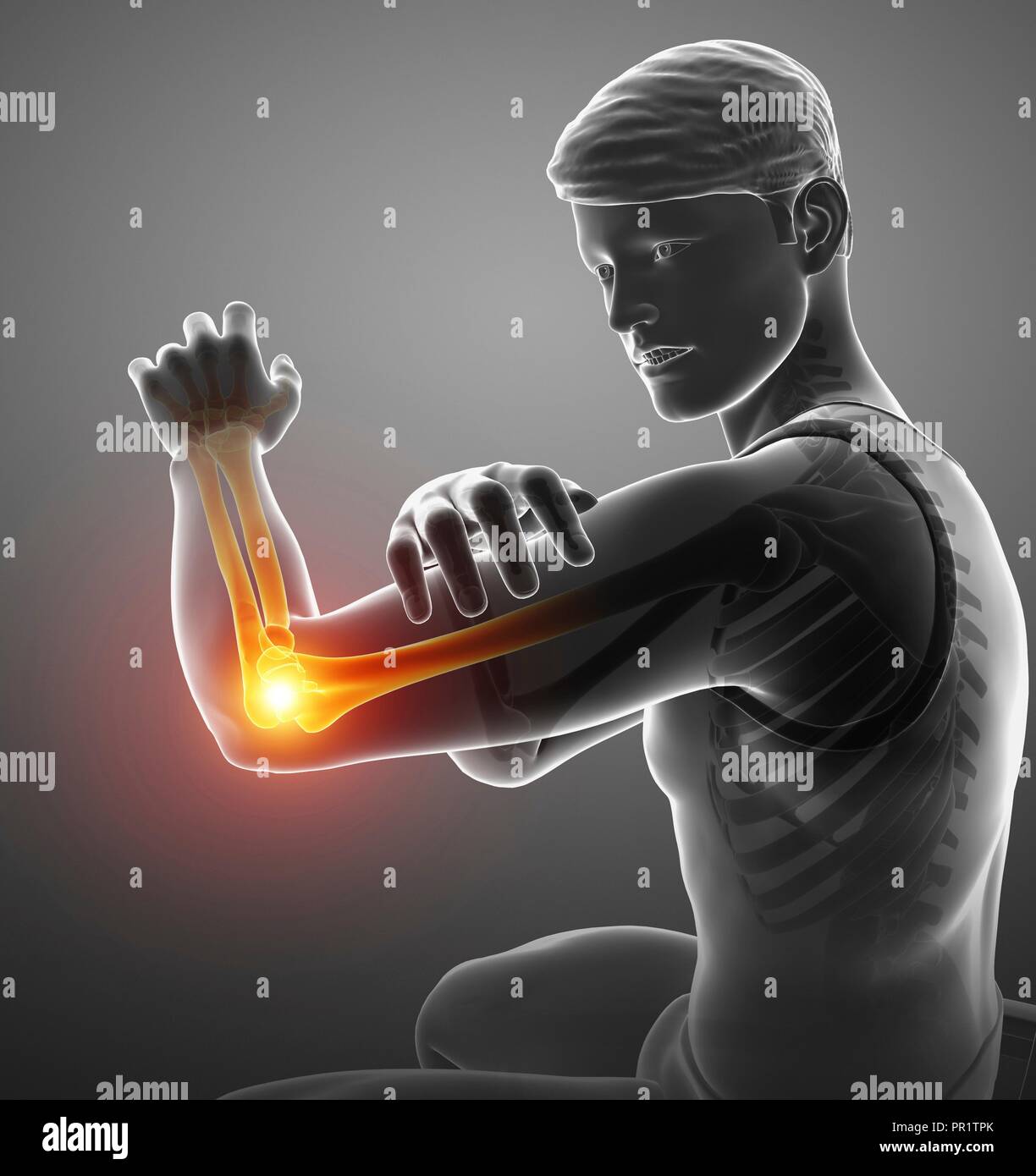 Man with elbow pain, computer illustration Stock Photo - Alamy