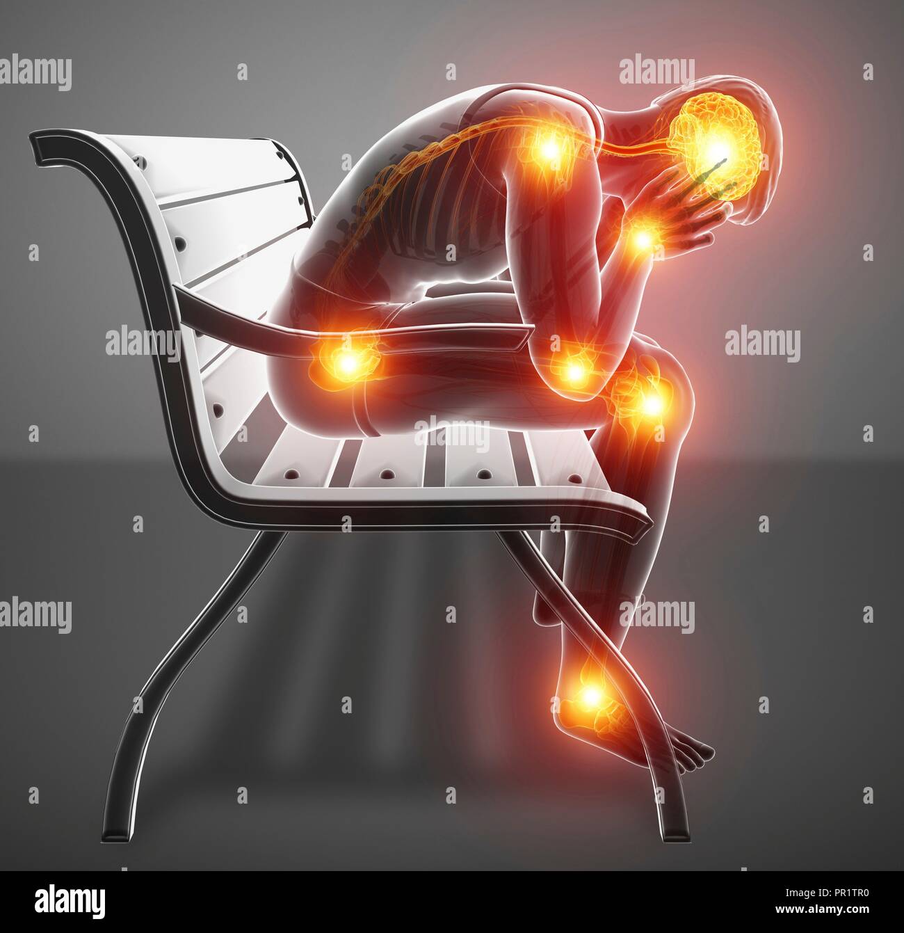 Man with joint pain, computer illustration Stock Photo - Alamy