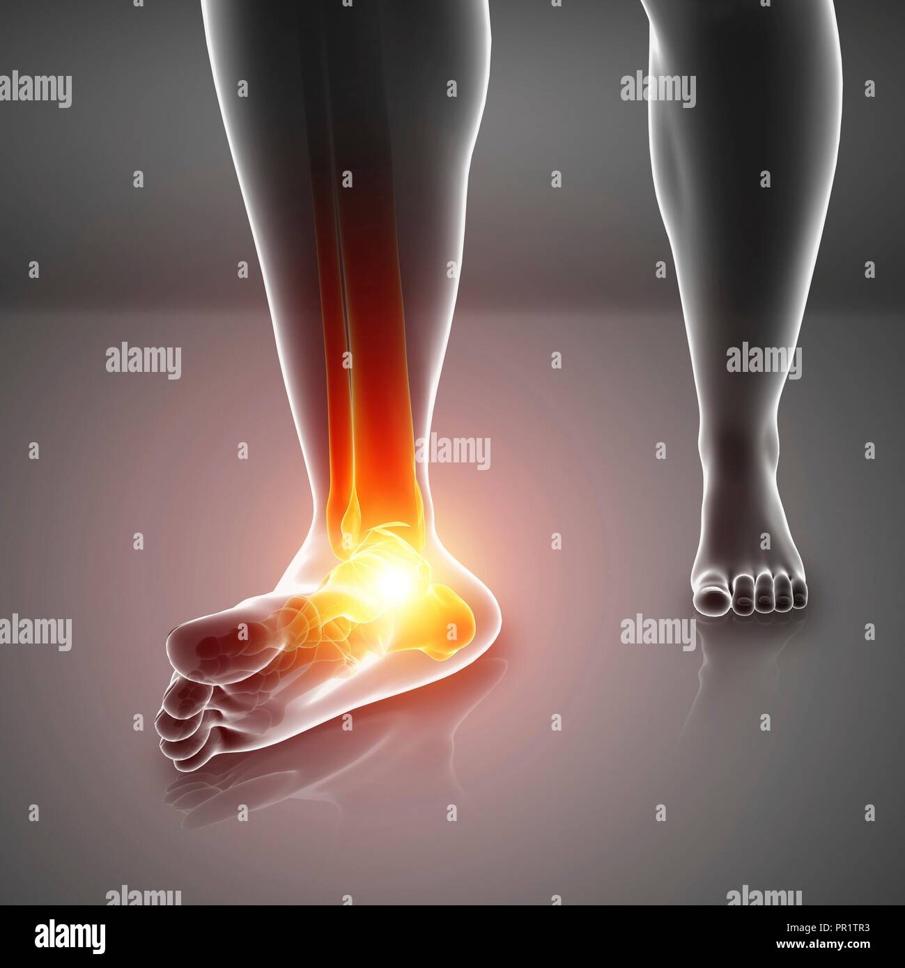 Twisting pain hi-res stock photography and images - Alamy