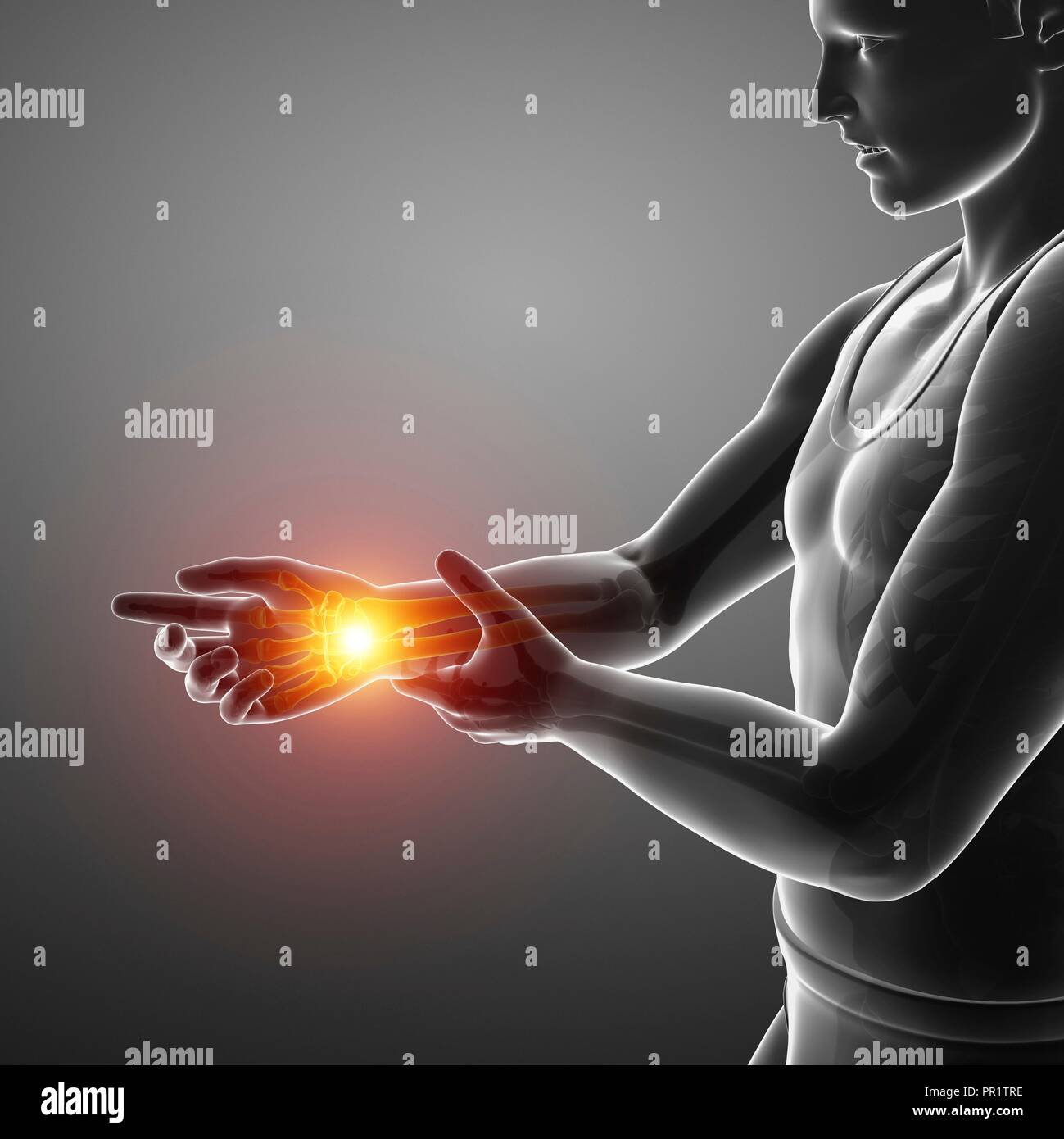 Man with wrist pain, computer illustration Stock Photo - Alamy