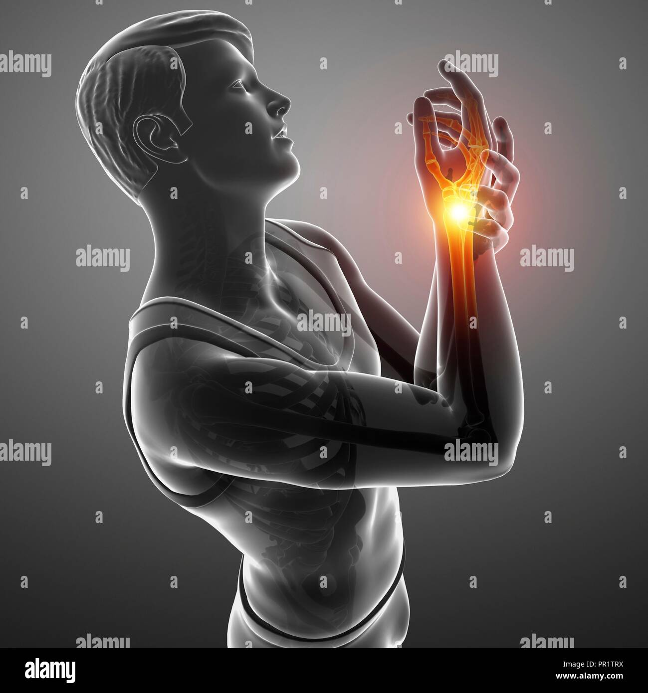 Man with wrist pain, computer illustration Stock Photo - Alamy