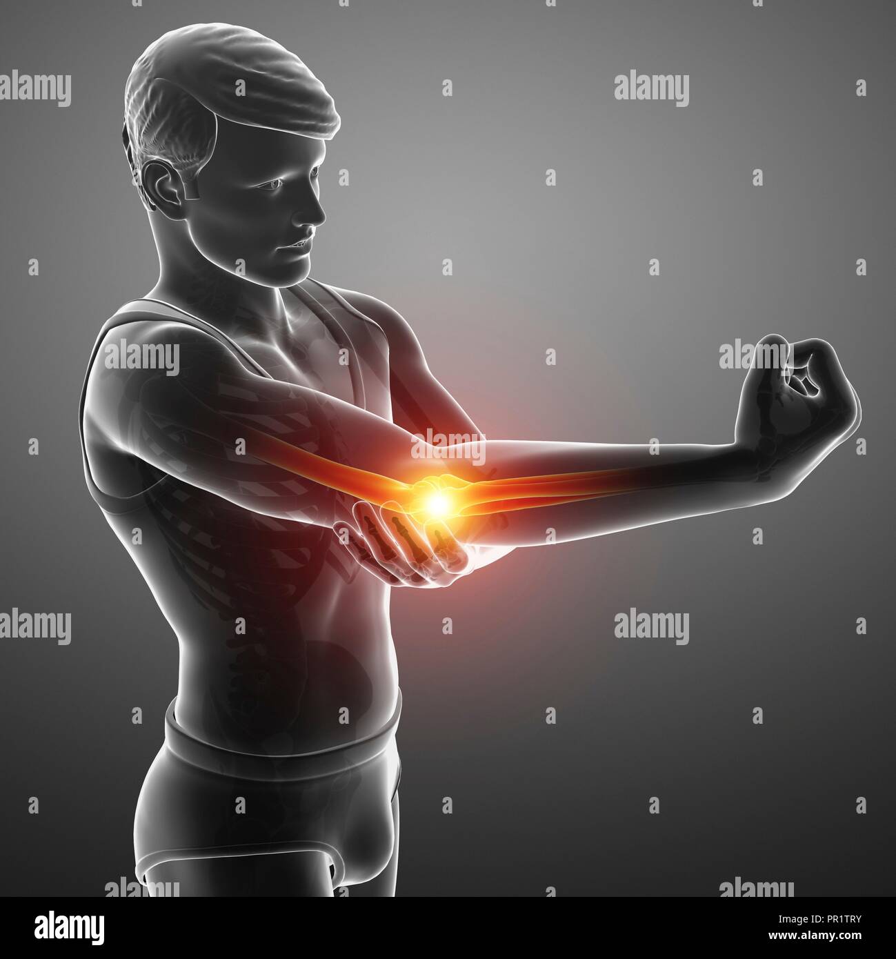 Man with elbow pain, computer illustration Stock Photo - Alamy