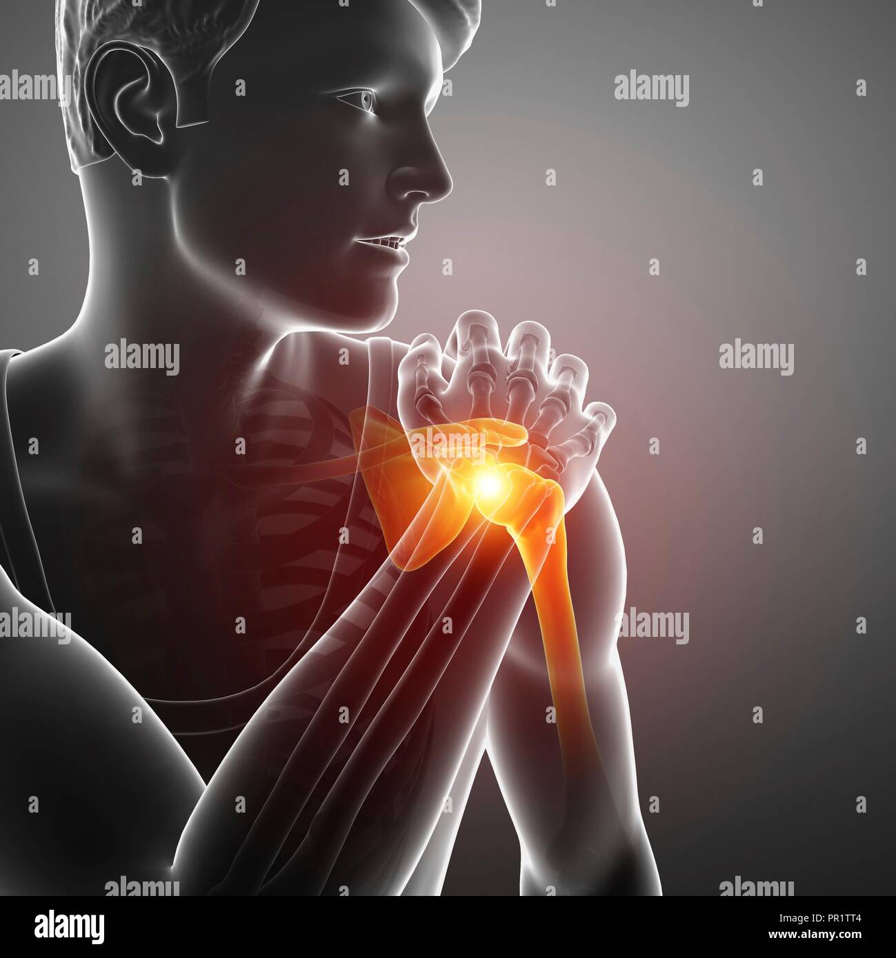 Man with shoulder pain, computer illustration Stock Photo - Alamy