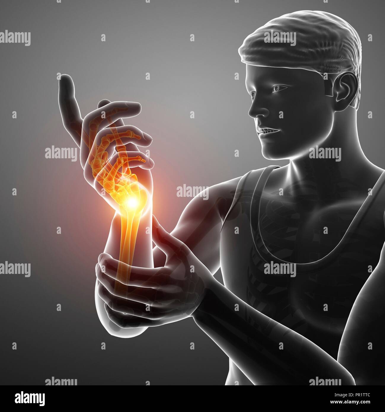 Man with wrist pain, computer illustration Stock Photo - Alamy