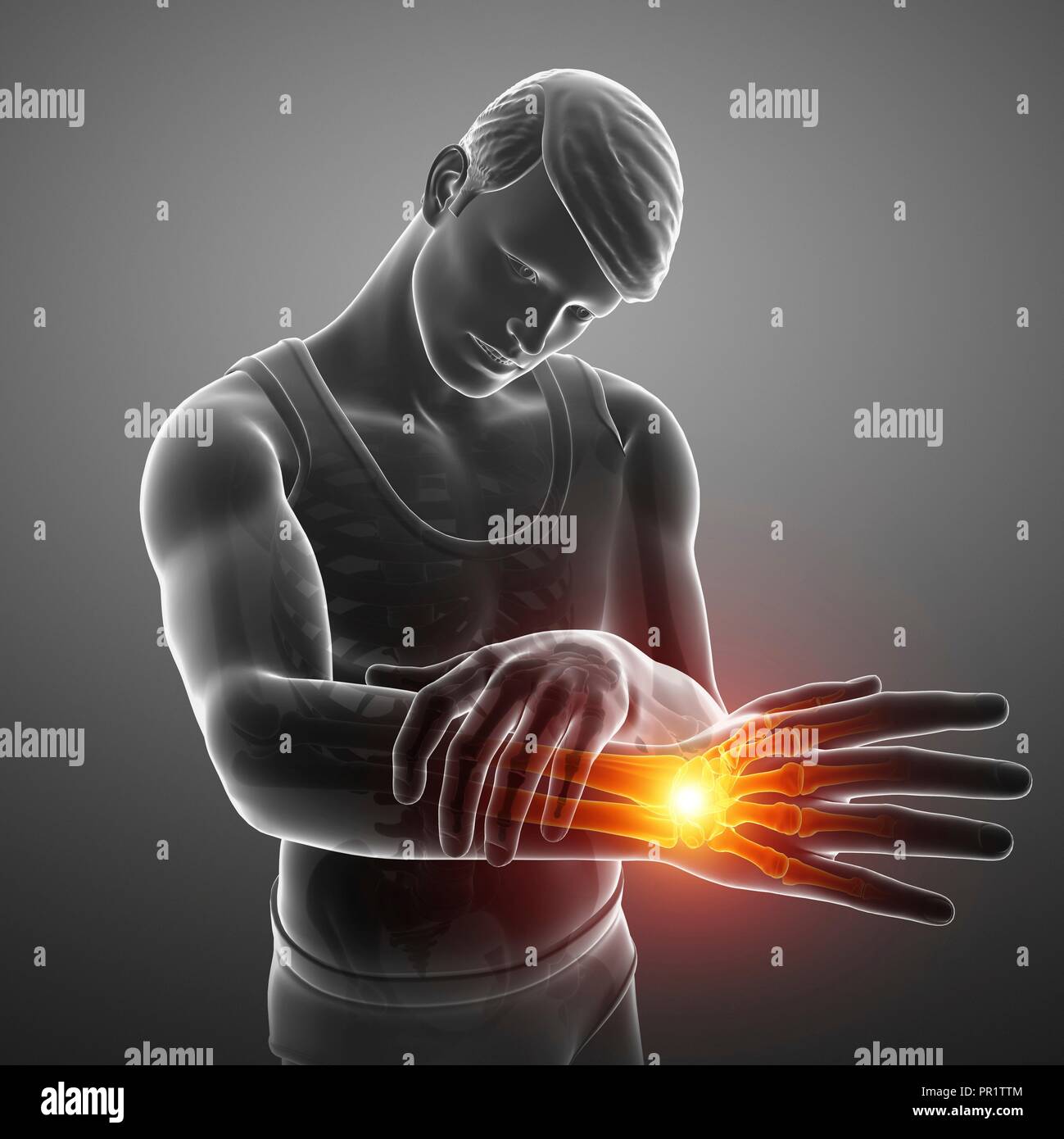 Man with wrist pain, computer illustration Stock Photo - Alamy