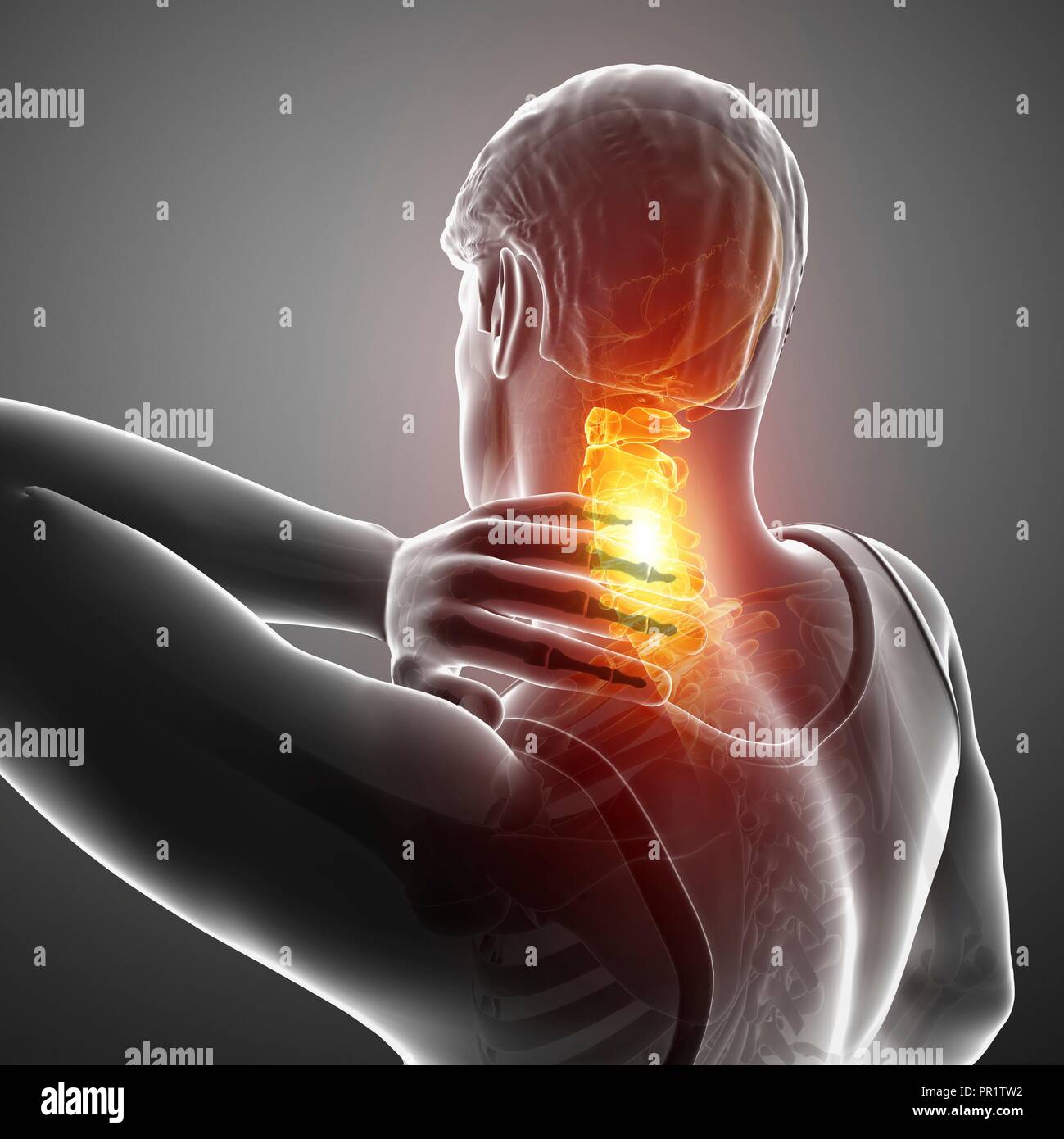 Man with neck pain, computer illustration Stock Photo - Alamy