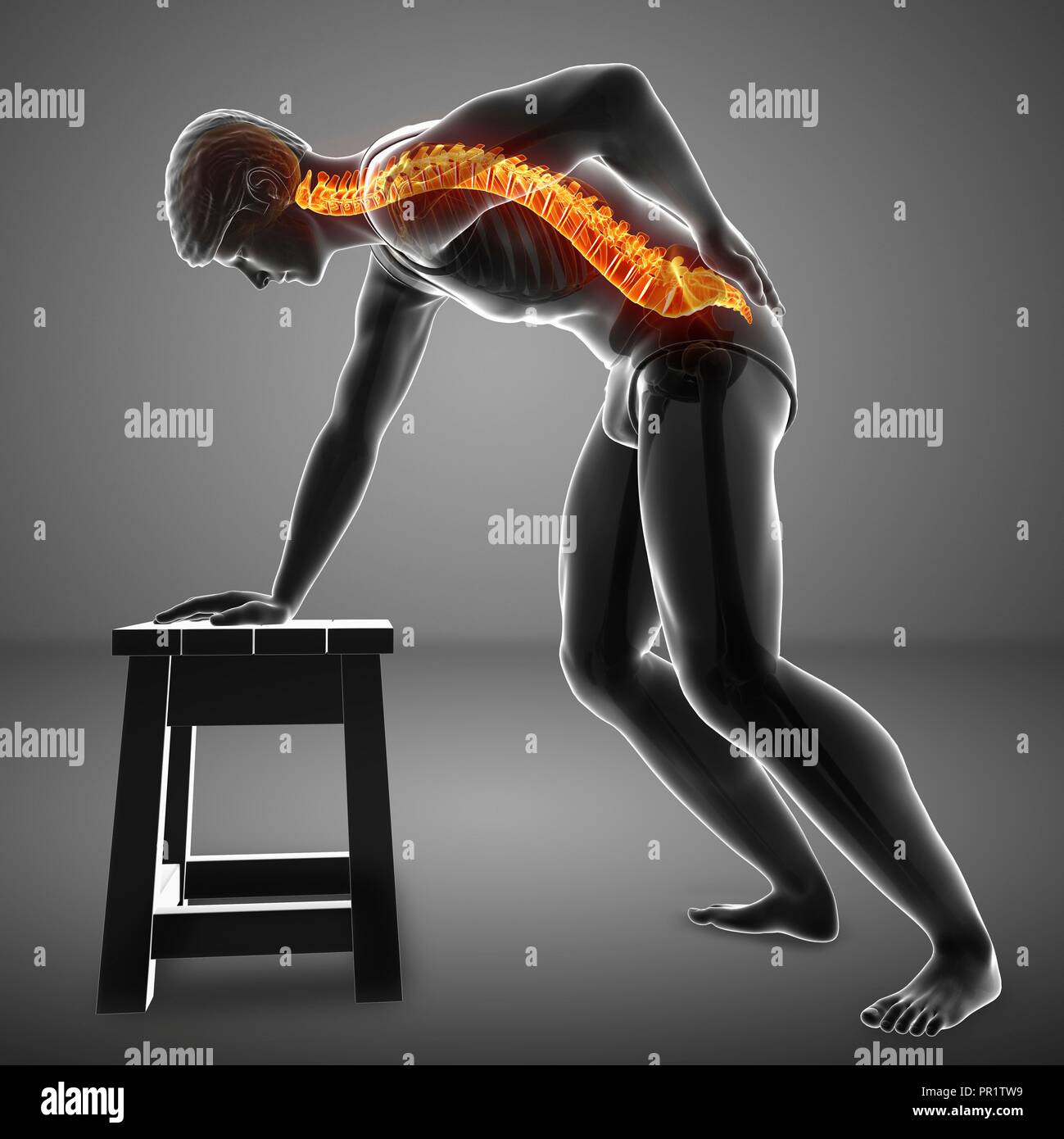 Man with back pain, computer illustration Stock Photo - Alamy