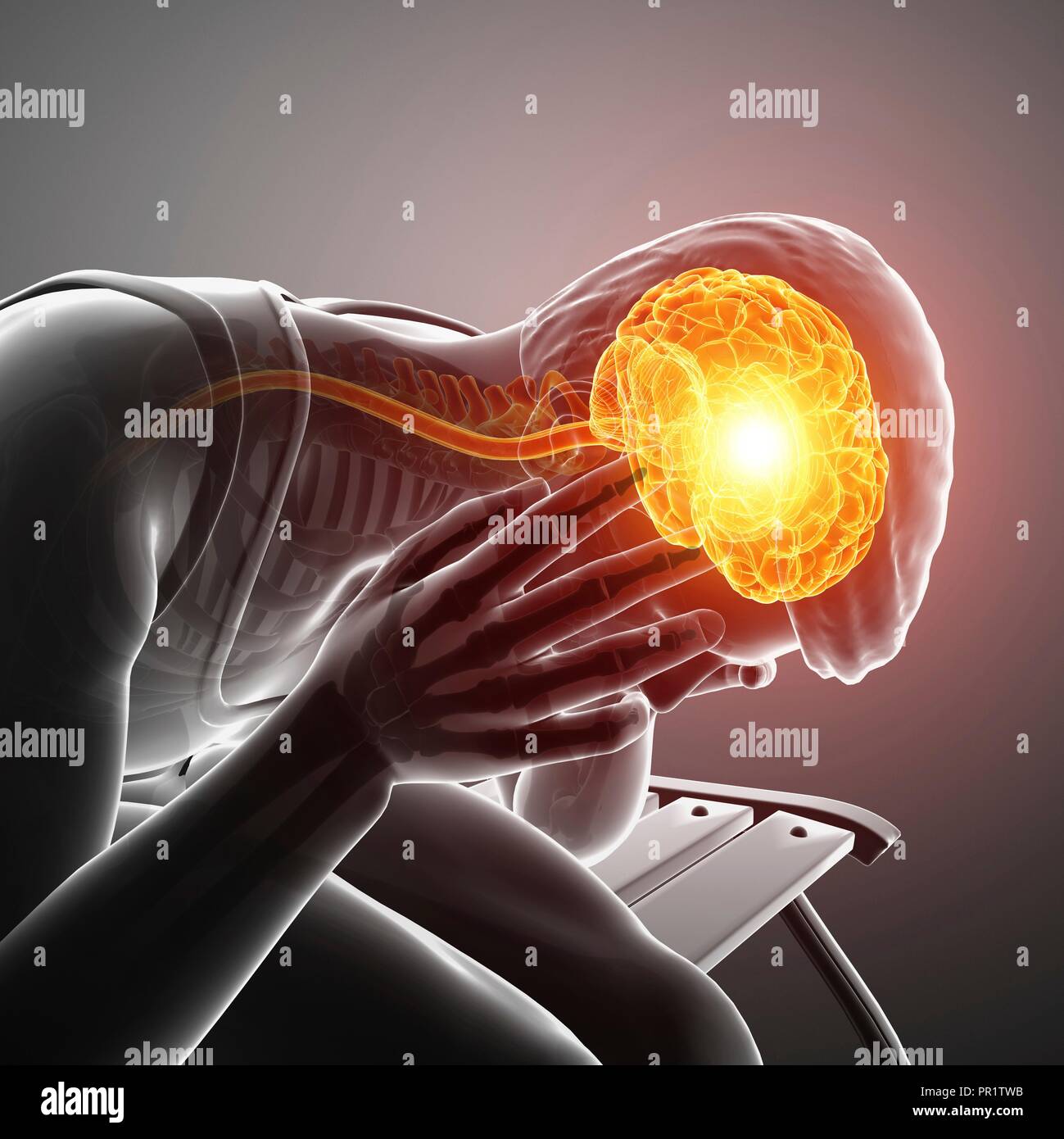 Man with headache, computer illustration Stock Photo - Alamy