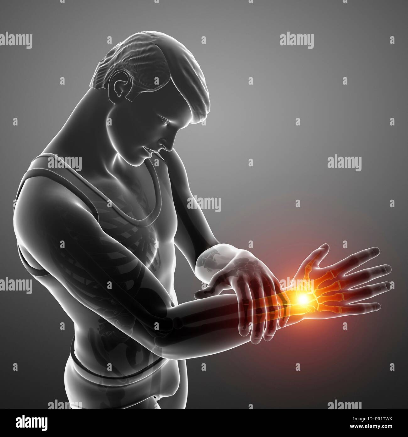 Man with wrist pain, computer illustration Stock Photo - Alamy
