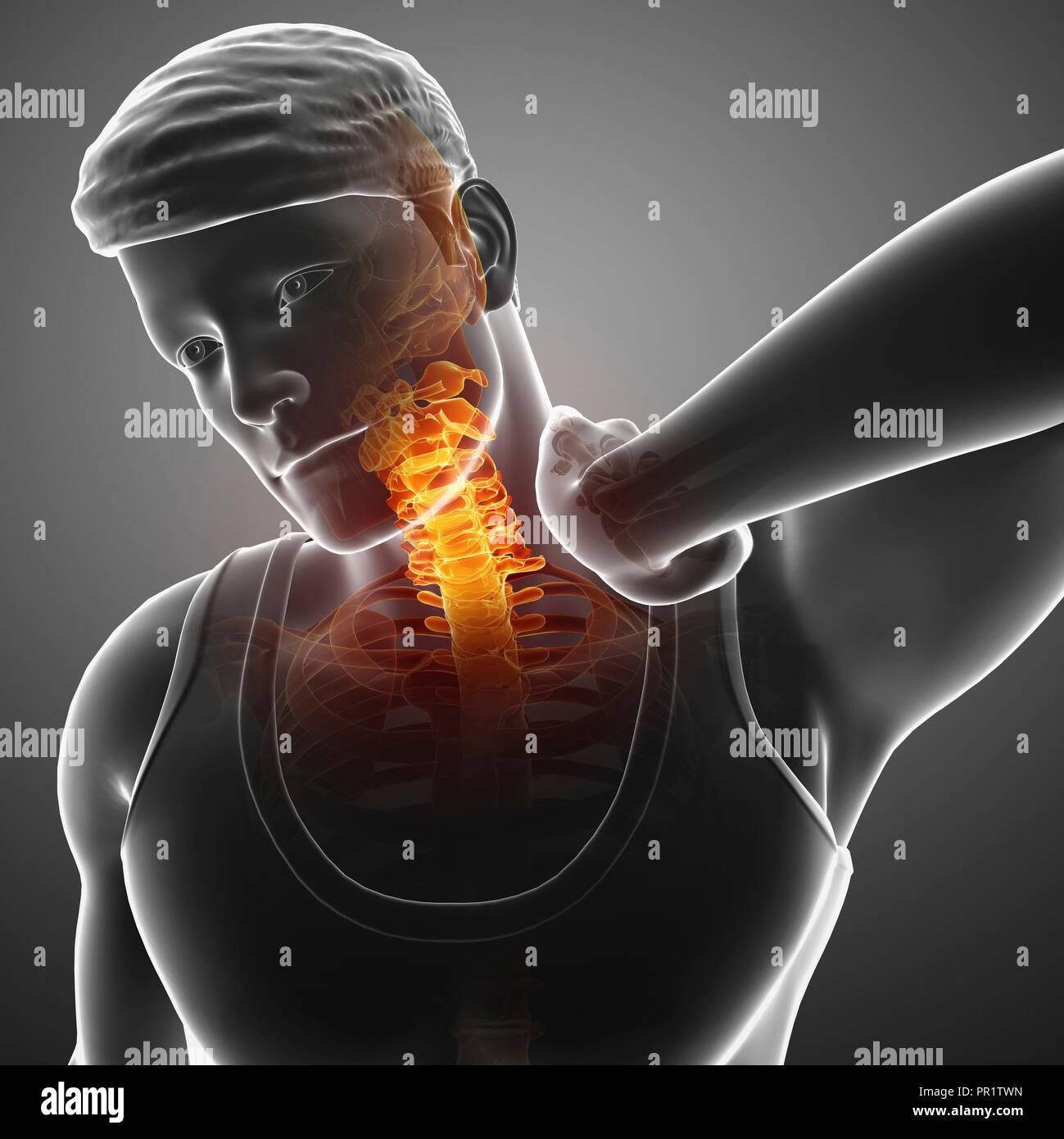 Man with neck pain, computer illustration Stock Photo - Alamy
