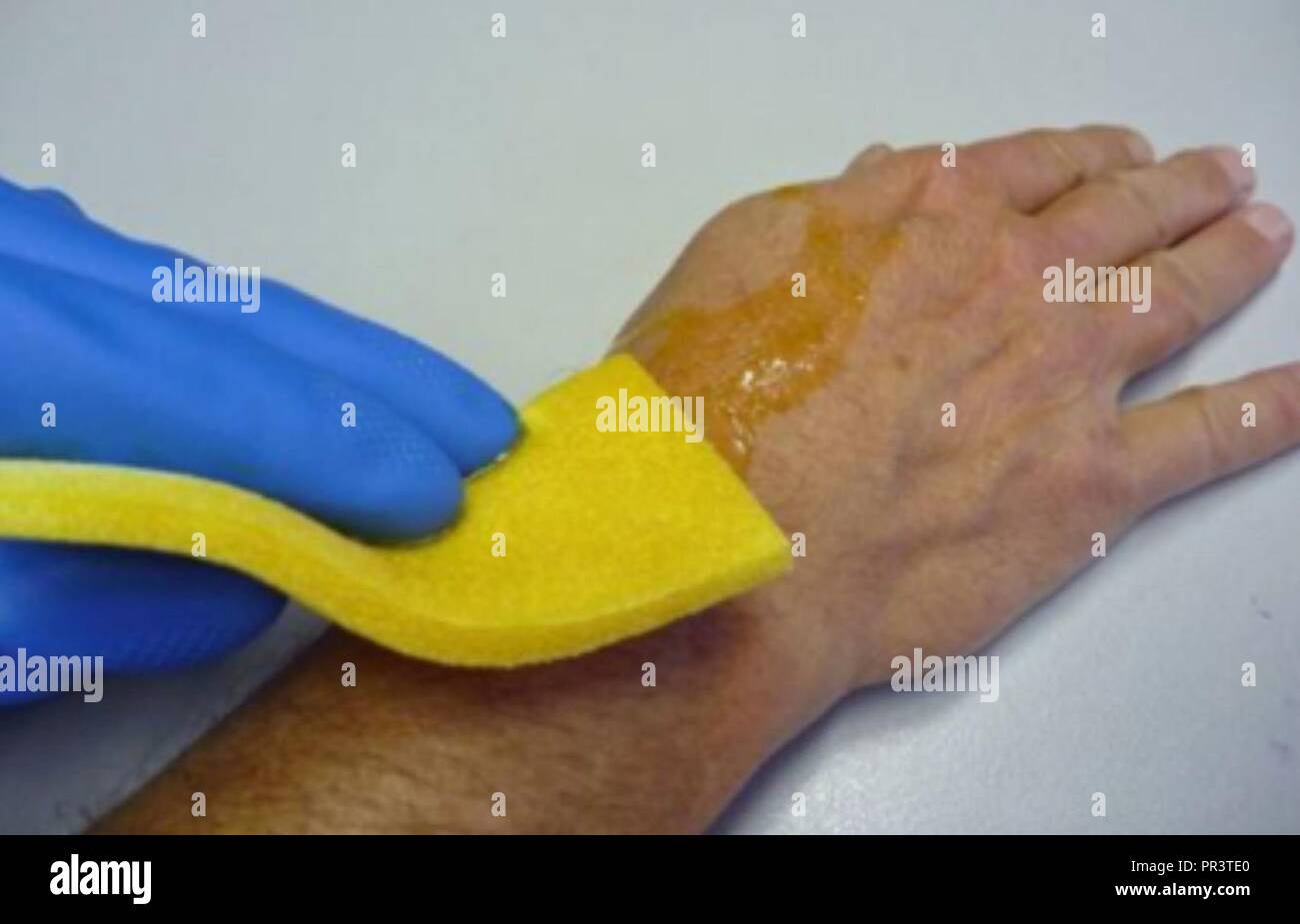 A researcher demonstrates how the RSDL medical countermeasure is ...