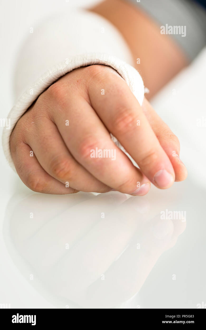 Broken arm and wrist in plaster hi-res stock photography and images - Alamy
