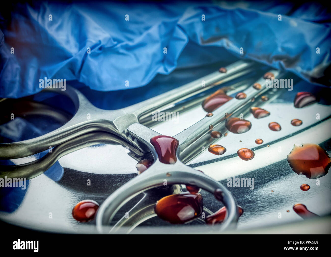 Gloves blue and scissors stained with blood on a tray in an operating ...