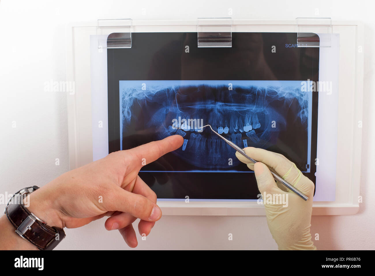 Dentist is showing to her patient an x-ray Stock Photo - Alamy