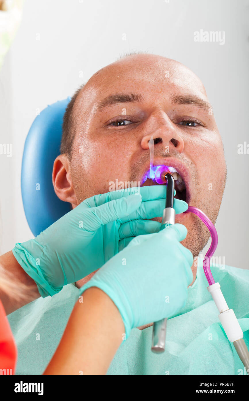 Dental treatment with polymerization lamp in oral cavity Stock Photo ...