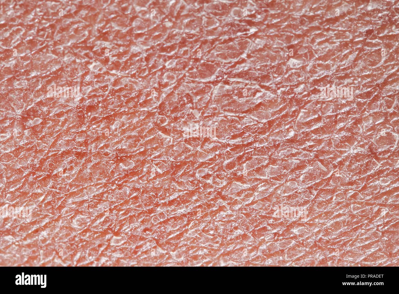 background texture of unhealthy human skin covered with deep wrinkles ...