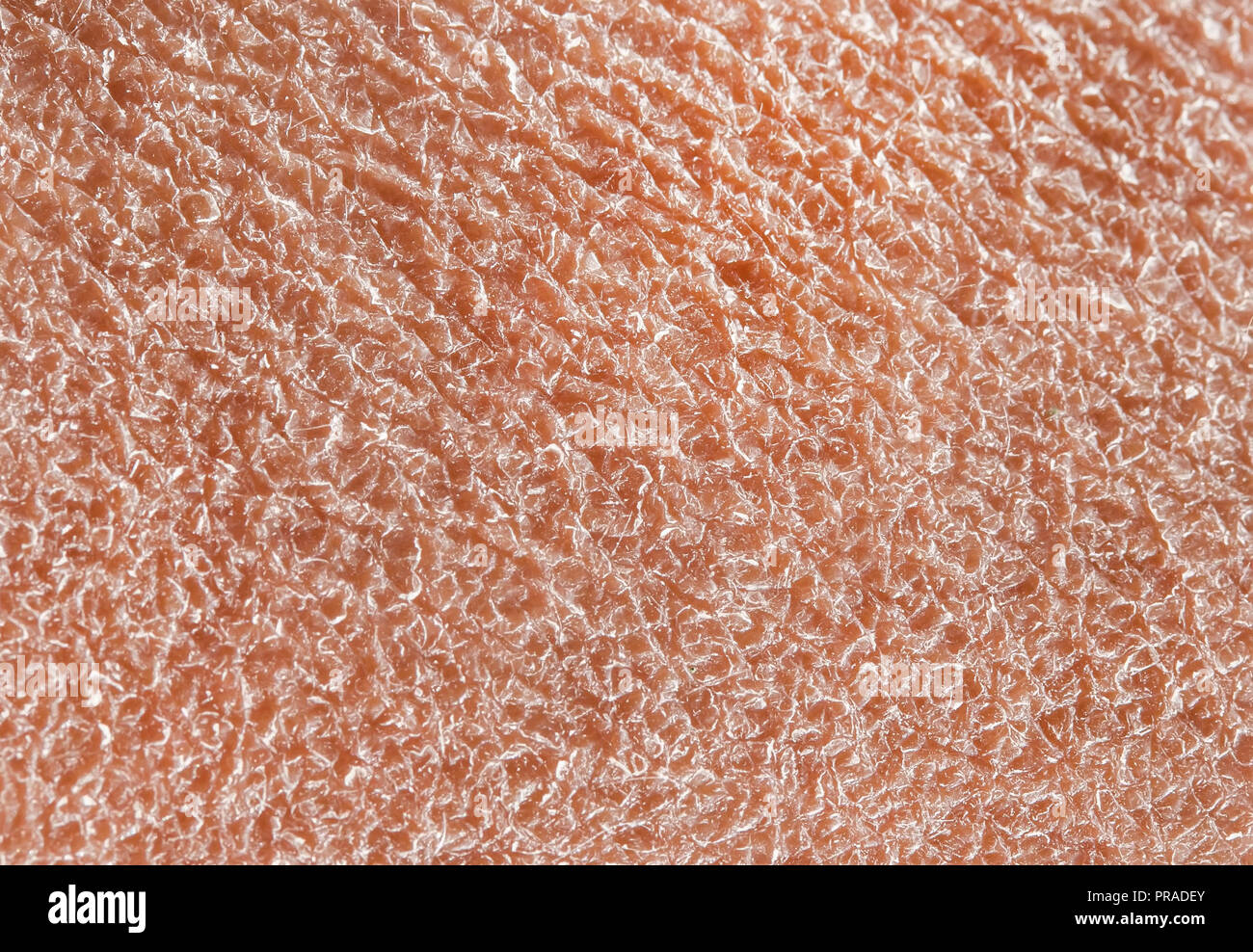 background texture of unhealthy human skin covered with deep wrinkles ...