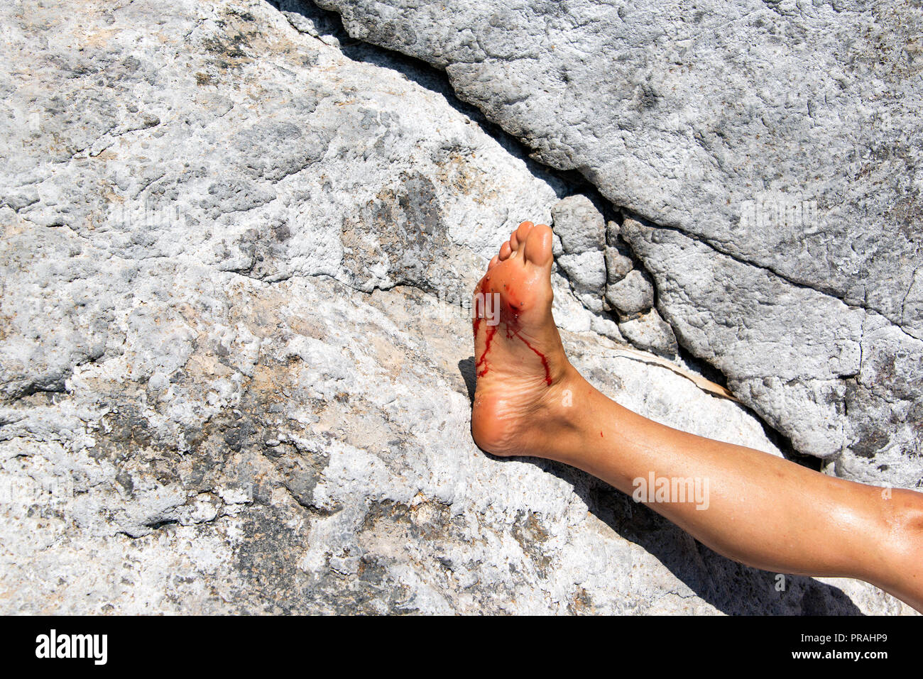 Bleeding foot hi-res stock photography and images - Alamy