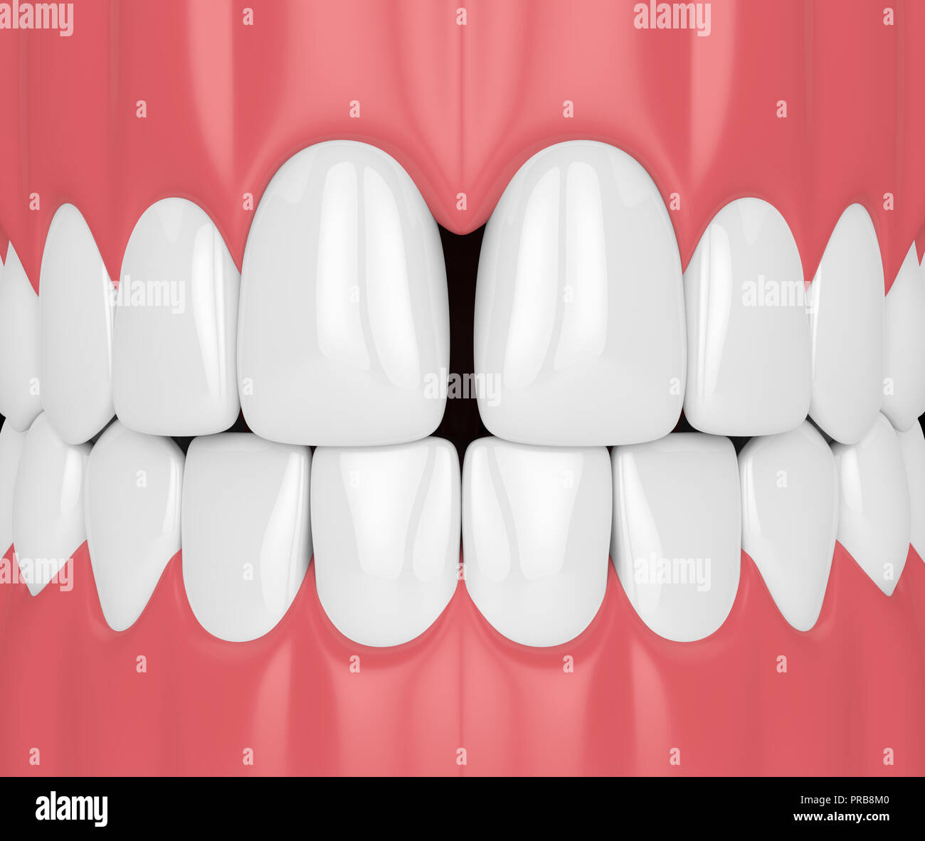 3d render of teeth with diastema. Dental disfunctions concept Stock ...