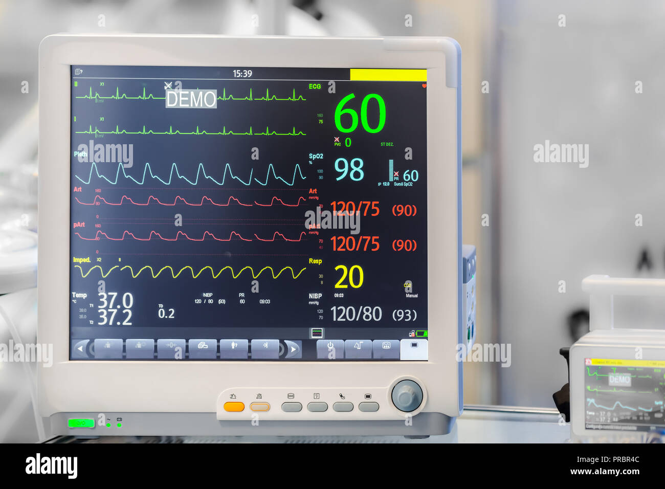 Unsustained ventricular tachycardia hi-res stock photography and images ...