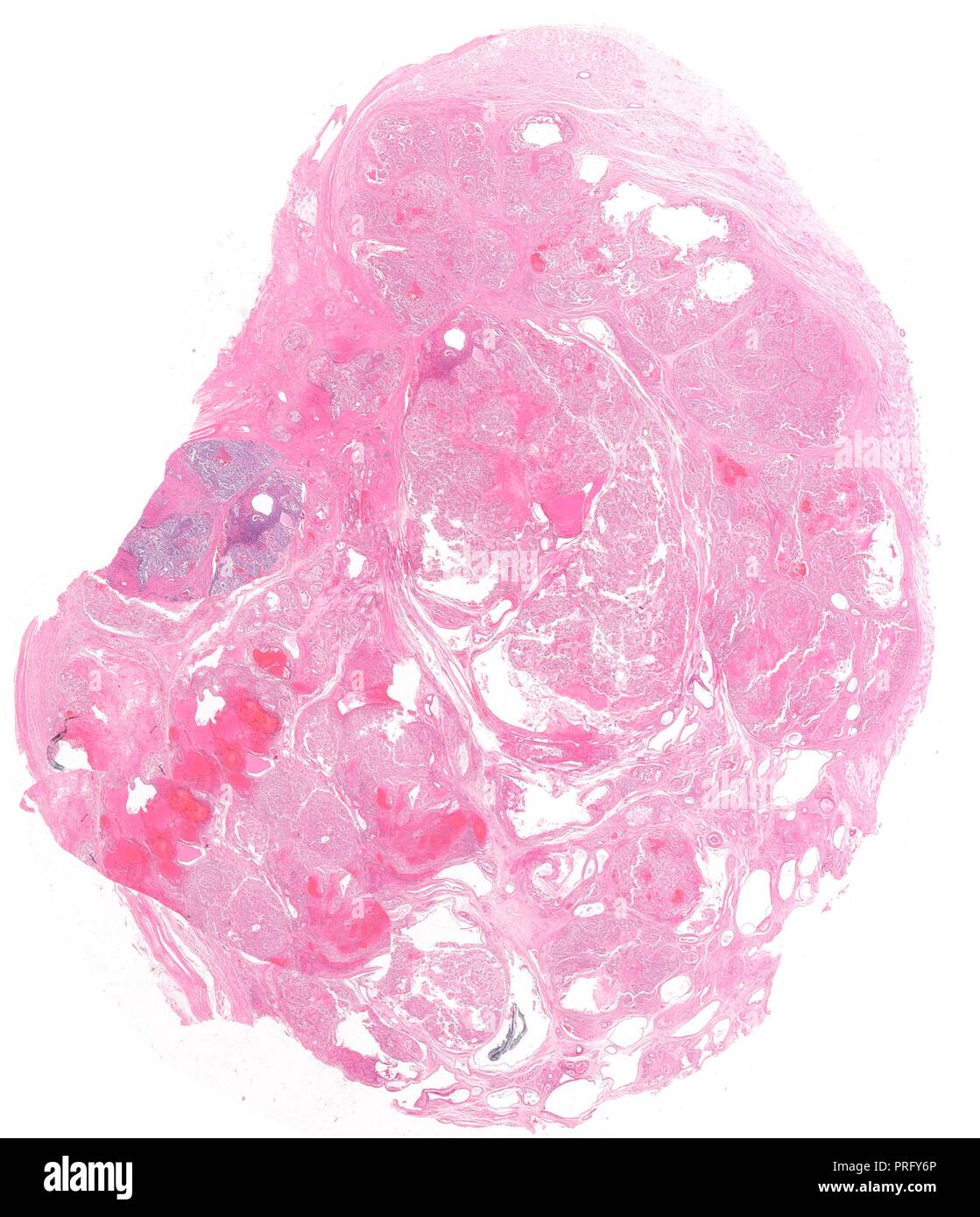 Human testicle hi-res stock photography and images - Alamy