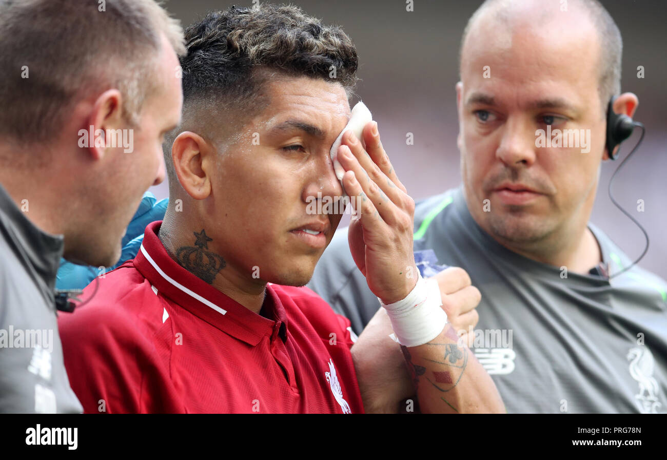 Eye gouge hi-res stock photography and images - Alamy