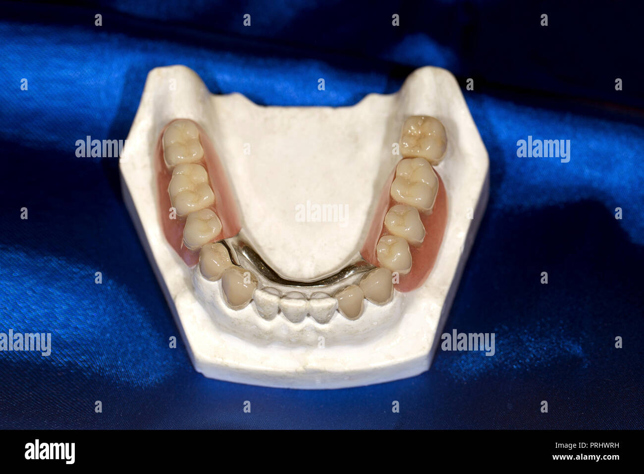 artificial gum with teeth close-up, on a blue background Stock Photo ...