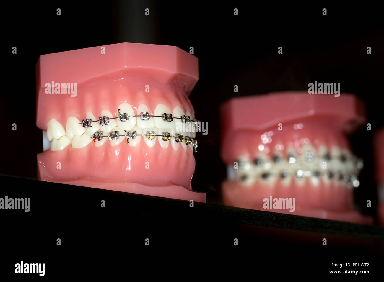 artificial jaw with metal braces on a dark background with space for ...