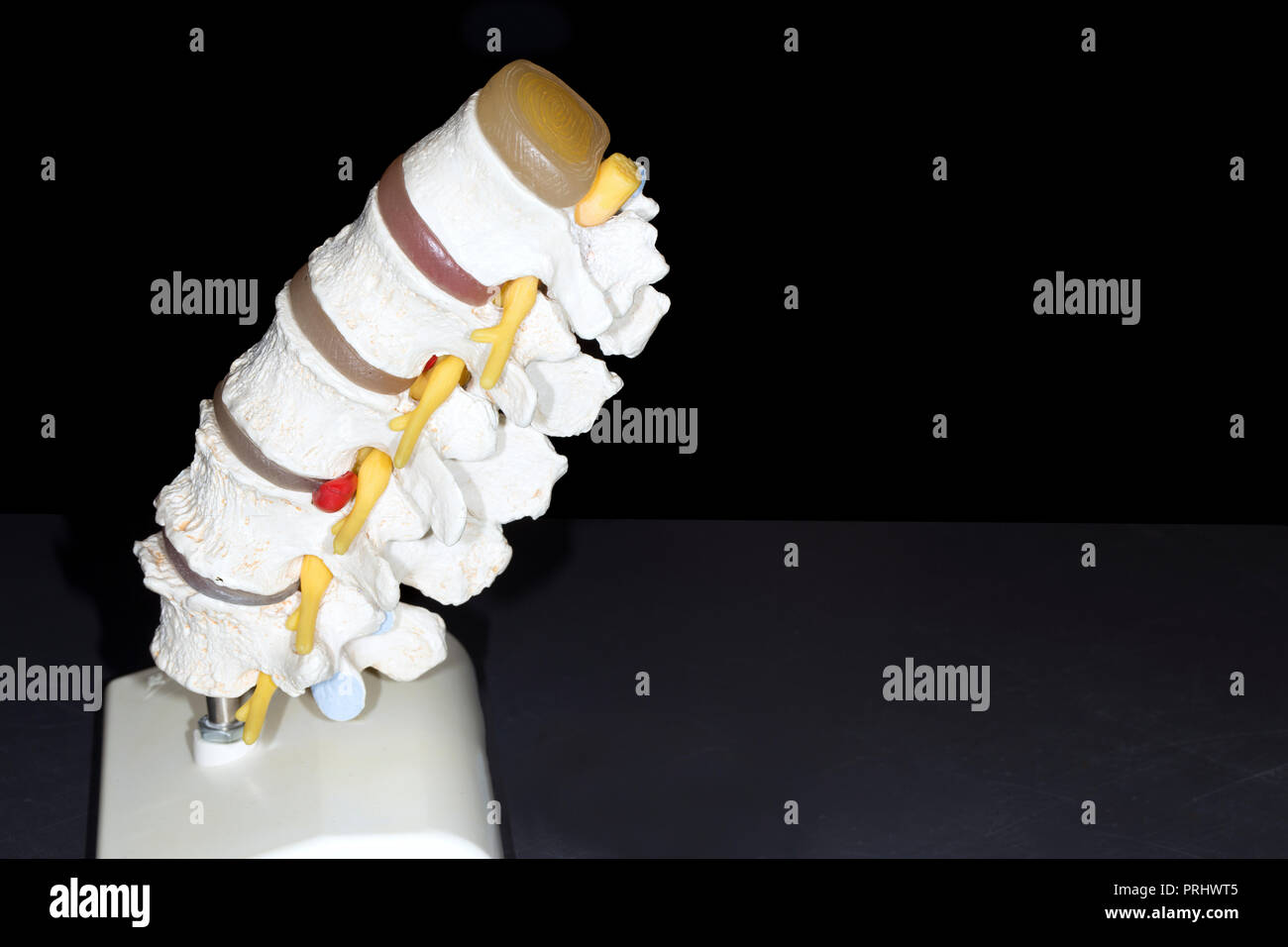 Side view model backbone spinal of five vertebra on black background ...