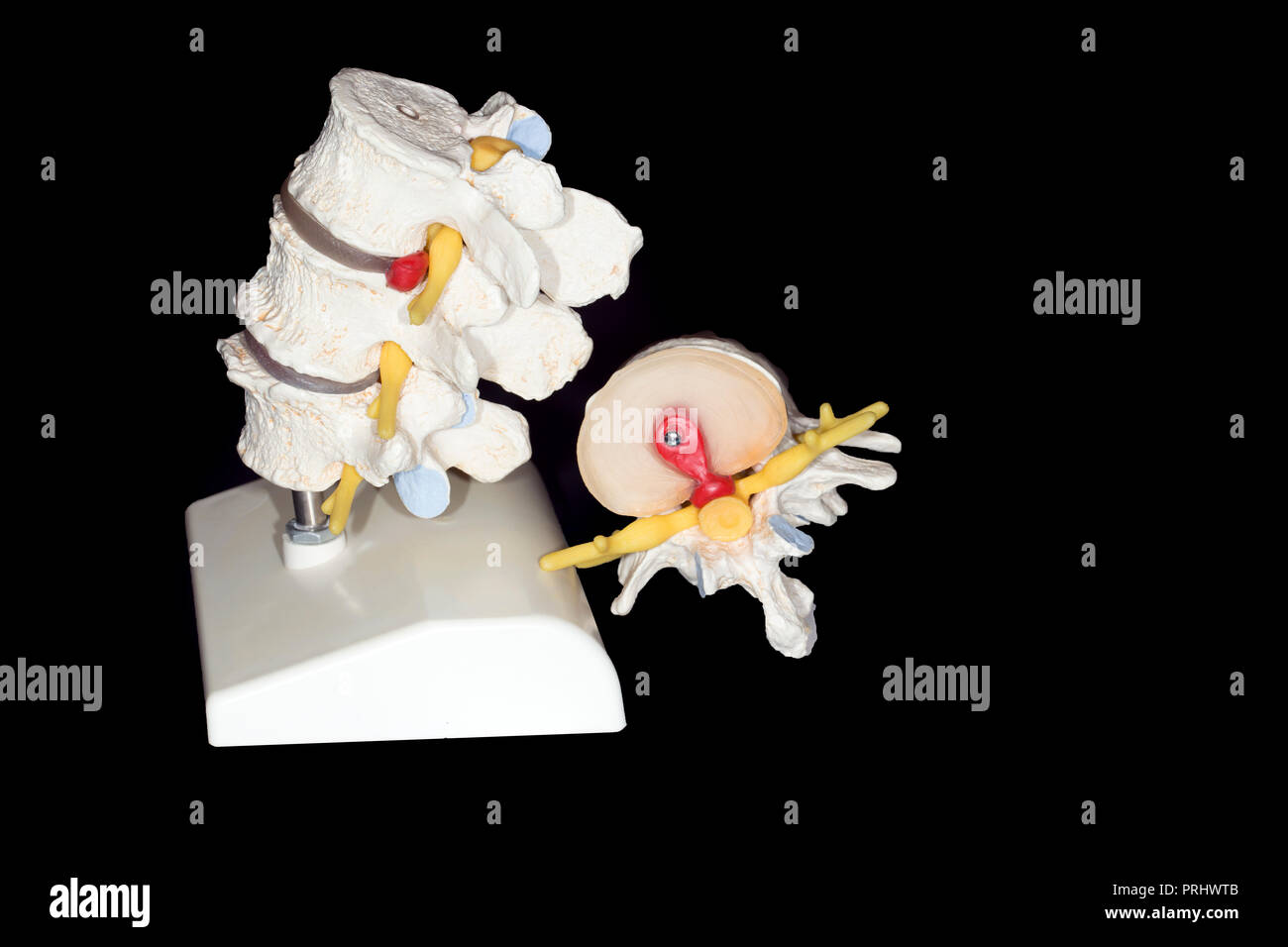 Side view model backbone spinal of five vertebra on black background ...