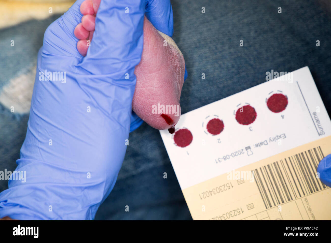 Newborn / new born baby undergoes neonatal heel prick screening ...