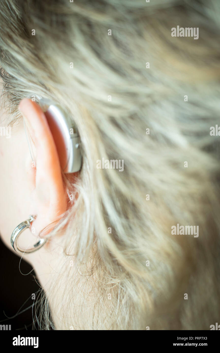 Deaf lady with modern technology digital hearing aid in her ear Stock ...