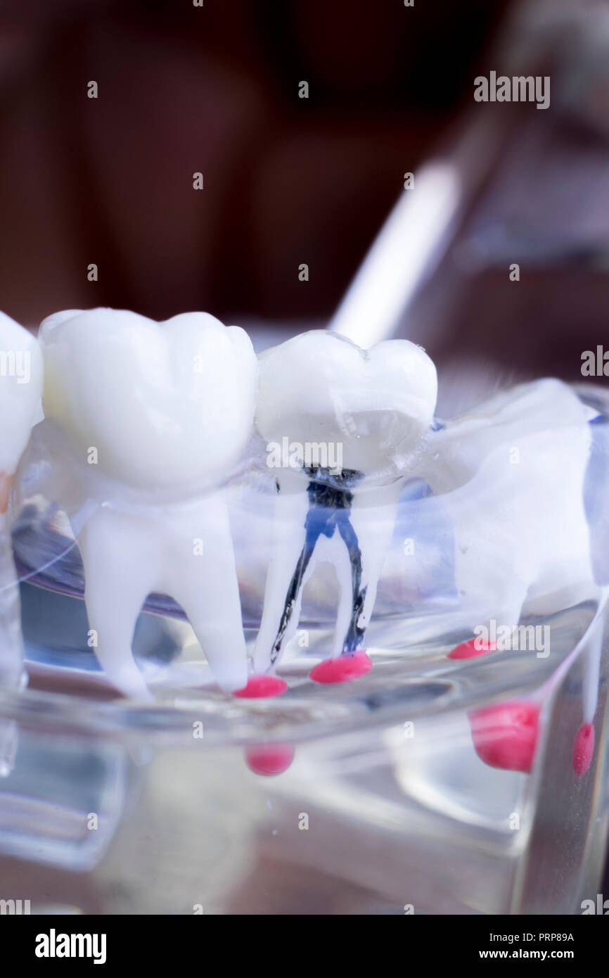 Dentist dental teeth teaching model showing each tooth and gum for ...