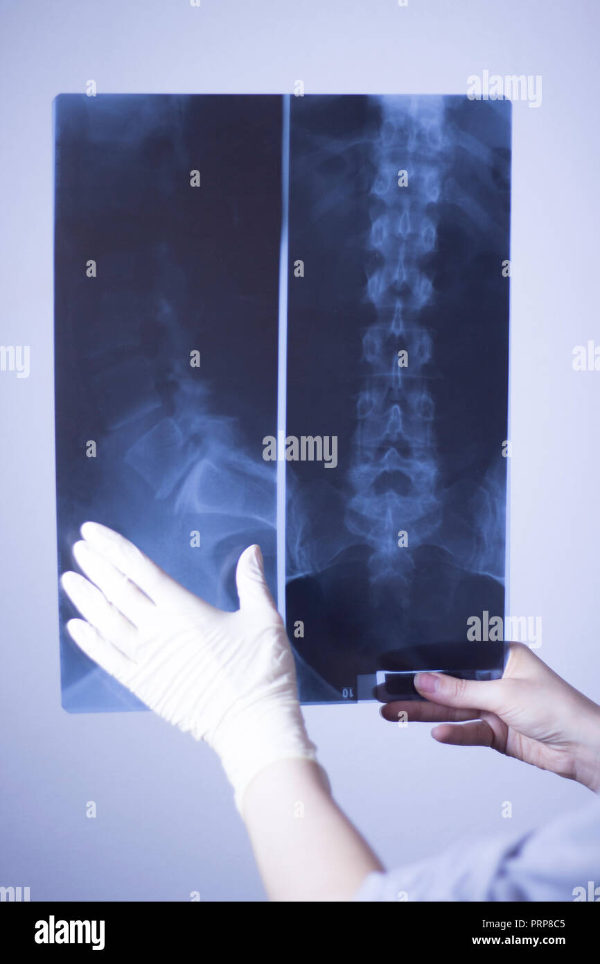 Medical hospital x-ray lowe back pain spine and hips traumatology scan ...