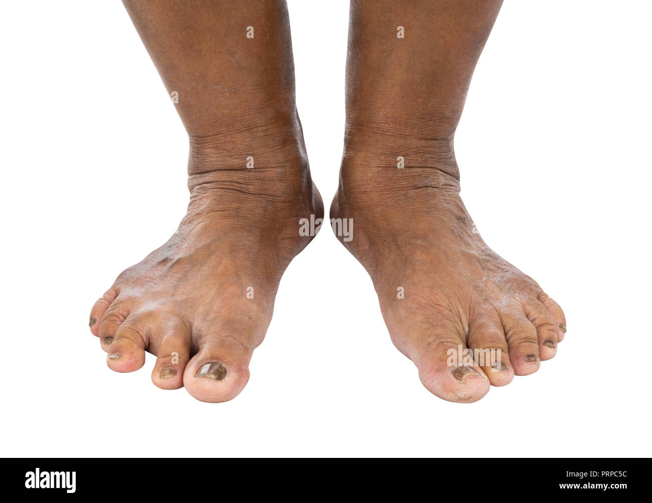 feet of senior woman isolated on a white background Stock Photo - Alamy