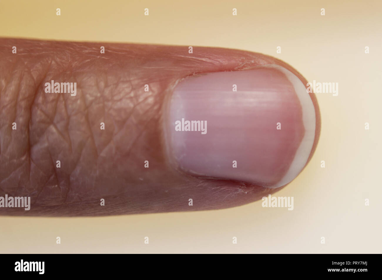 Without nail hi-res stock photography and images - Alamy