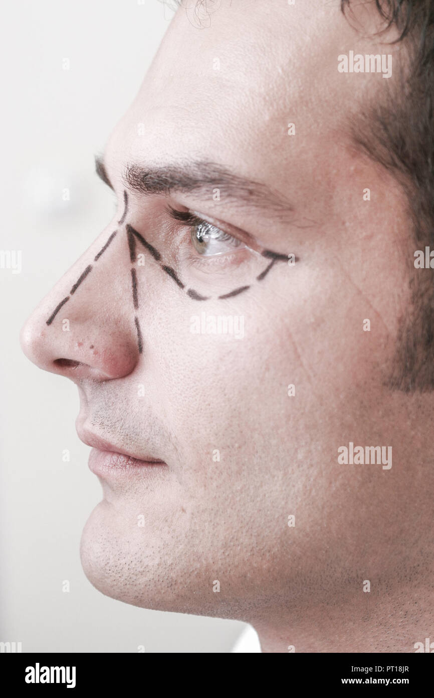 Facelift Model High Resolution Stock Photography and Images - Alamy