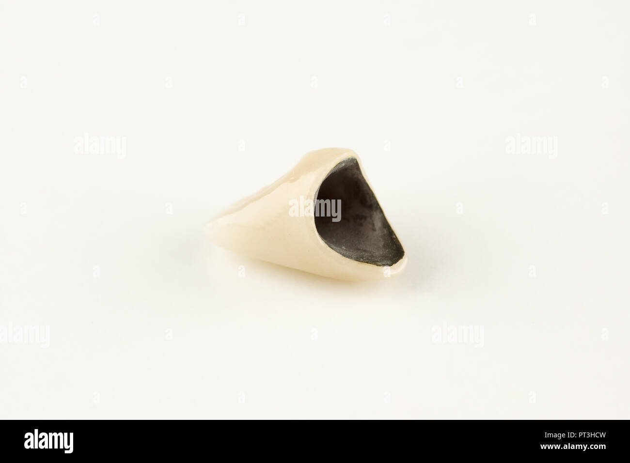 cast and cermet dental structures for restoration of teeth Stock Photo ...