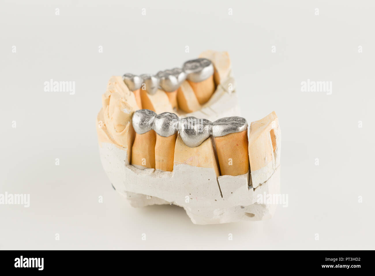 bases of metal-cast bridges on an artificial dental model Stock Photo ...