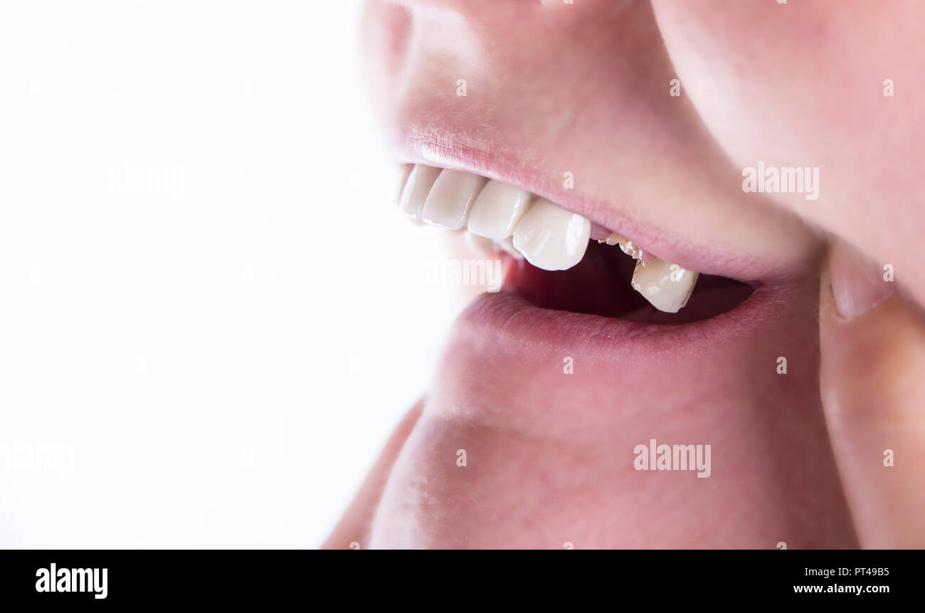 Victor Ortiz Broken Jaw X Ray