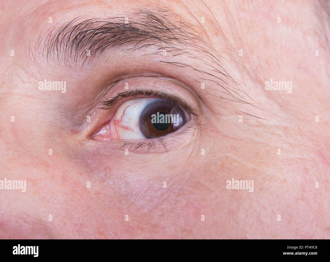 The veins in overworked eye from computer Stock Photo - Alamy