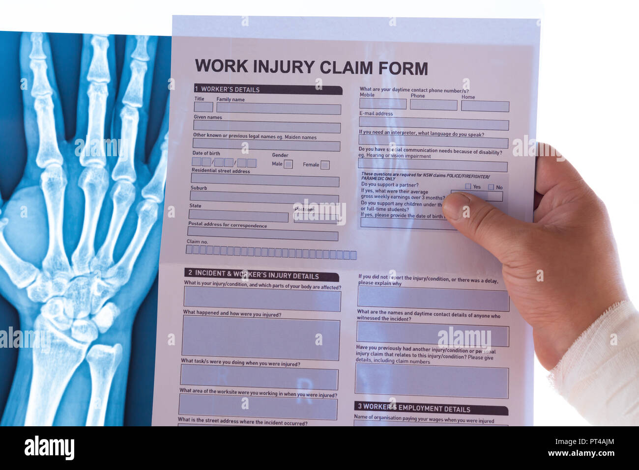 man reading a work injury claim form with a wrapped hand on top of an X ...