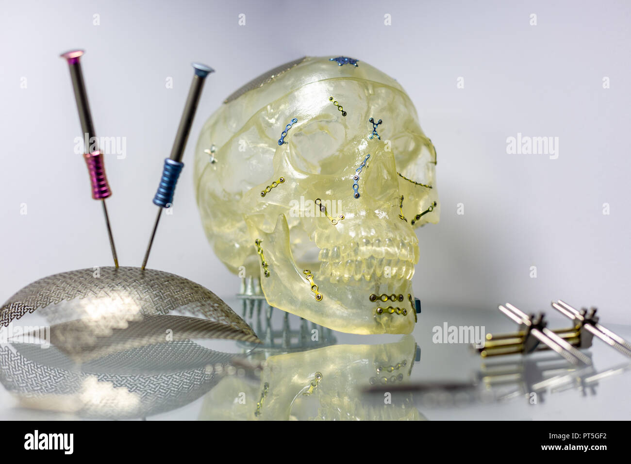 Tools and equipment for orthopedic and surgical reconstruction of the ...