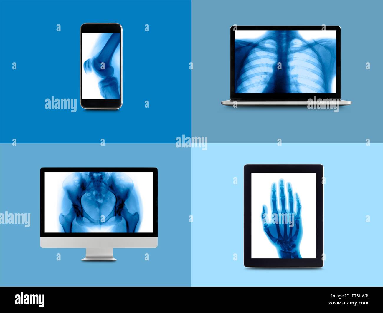 X-ray montage on digital device screens Stock Photo - Alamy