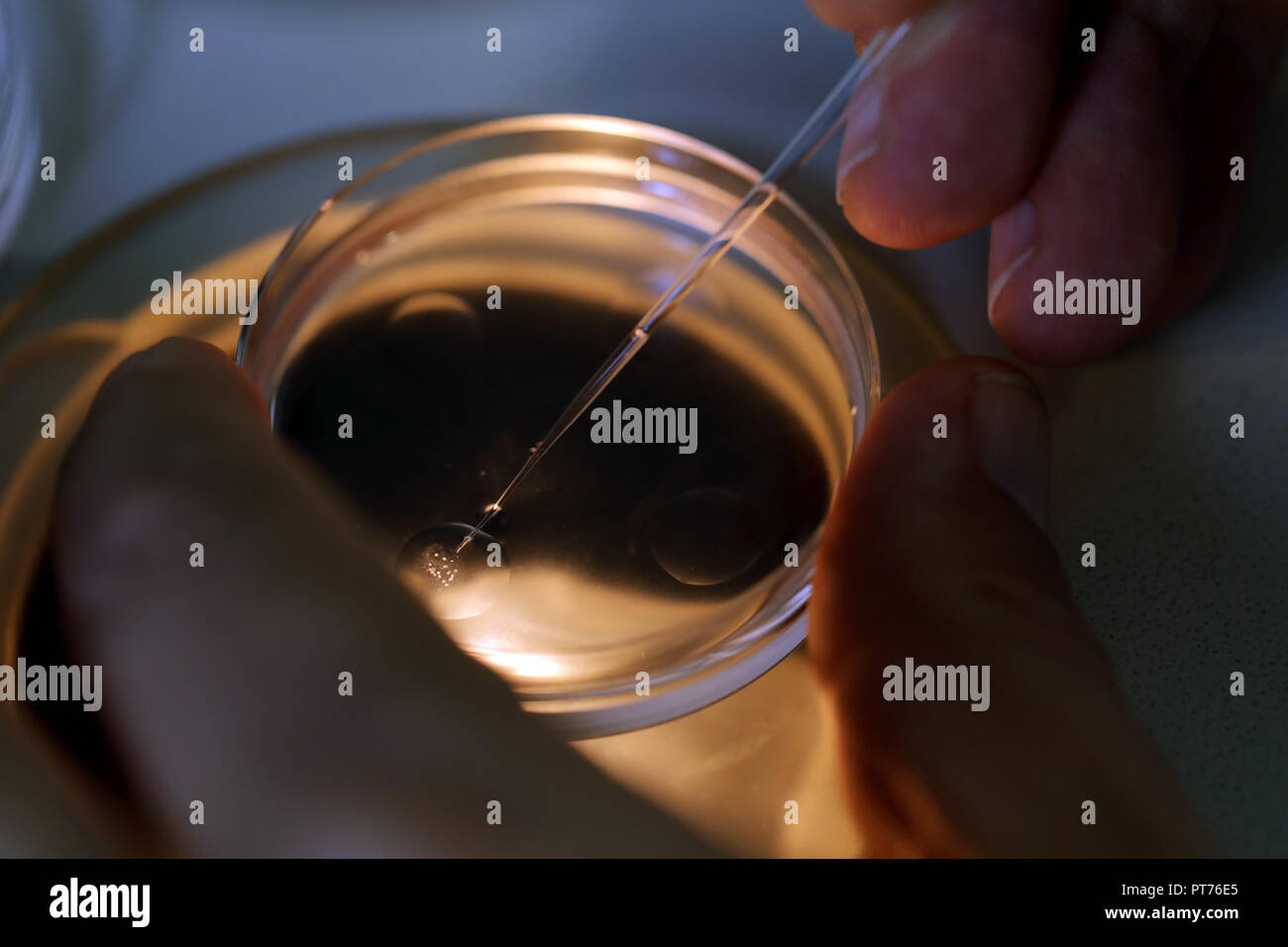 Ivf Process High Resolution Stock Photography and Images - Alamy