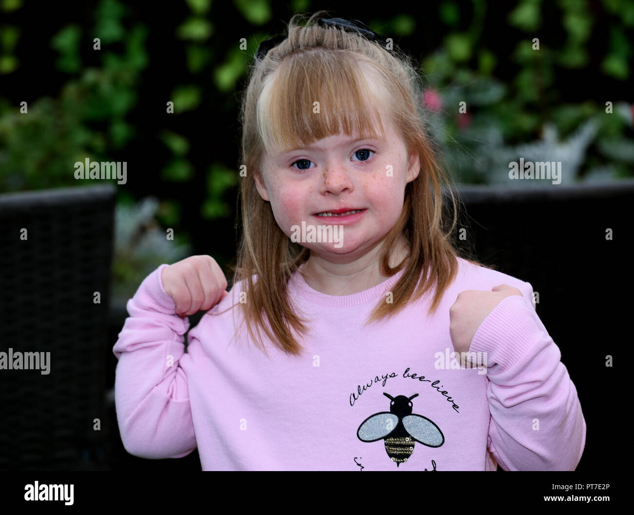 Down syndrome girl cook hi-res stock photography and images - Alamy