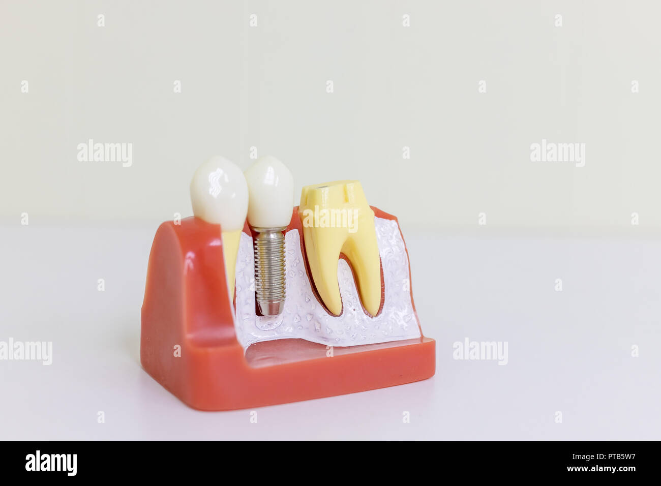 Dentsts dental prosthetic teeth, gums, roots teaching student model ...